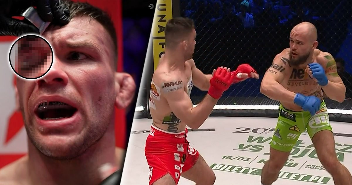 KSW 91: Łukasz Charzewski pomimo zamkniętego oka zwyciężył z Michałem ... KSW 91: Łukasz Charzewski pomimo zamkniętego oka zwyciężył z Michałem ...