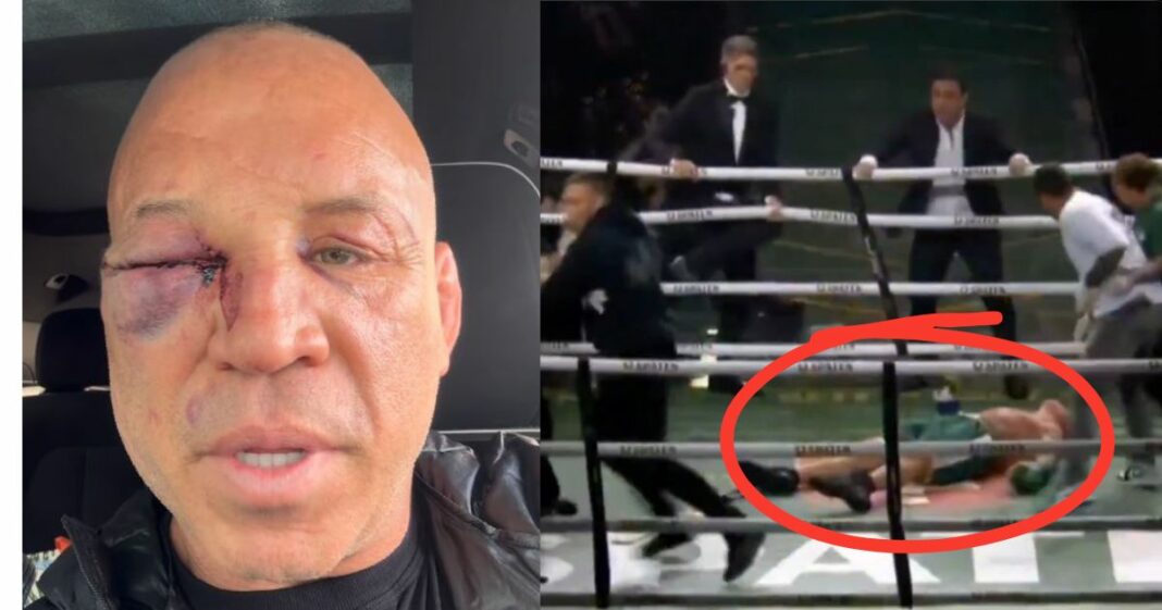 Wanderlei Silva ze złamanym nosem po bójce i dyskwalifikacji w walce ...